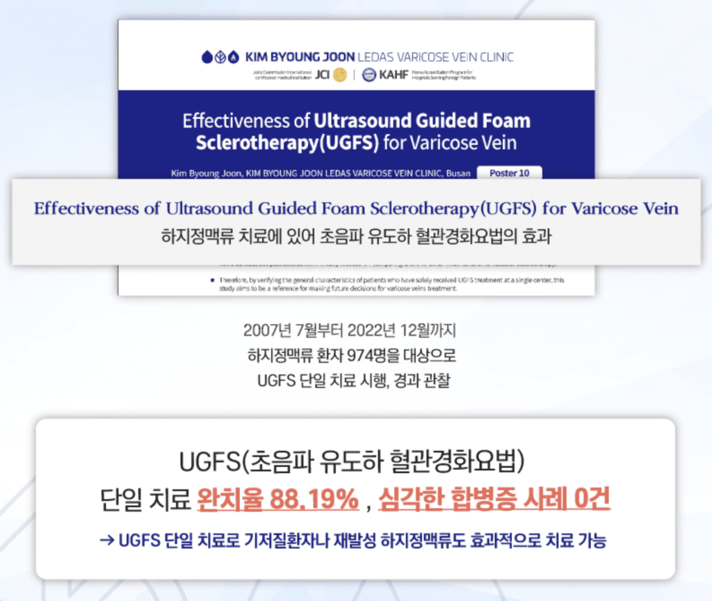 부산 하지정맥류 병원, 비수술적 치료법 - 김병준 원장의 건강한 다리 이야기